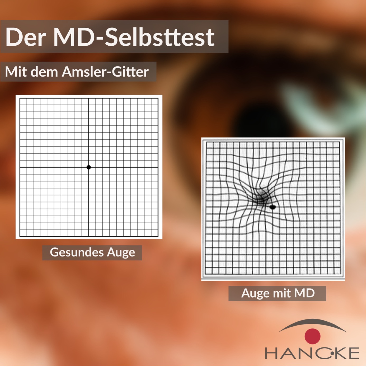 MD Selbsttest - Makuladegeneration - Heilpraktiker-Spezial-Praxis